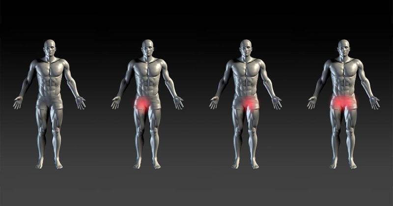Groin pain